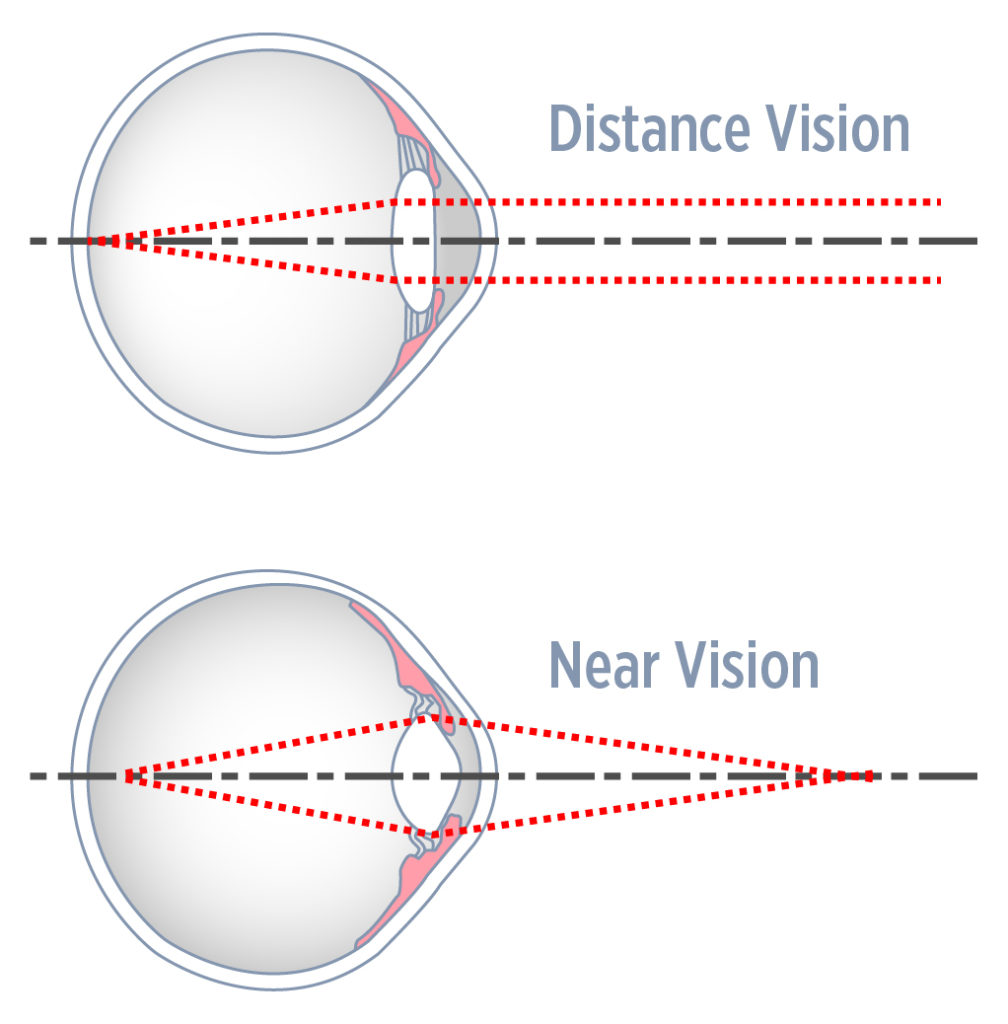 Eye Focusing Accommodation Eyecare Kids eye-focusing-accommodation-eyecare-kids