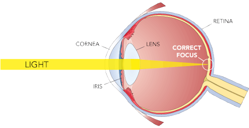 Optometry Terms and Eye Conditions Simply Explained | Eyecare Kids