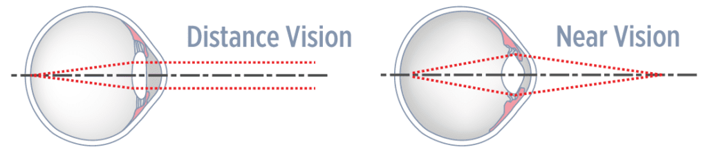 Eye Focusing Test in Sydney | Eyecare Kids
