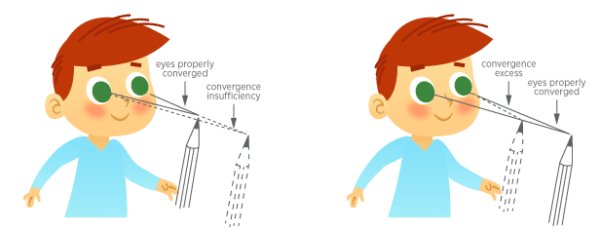 Eye Teaming Convergence Test in Sydney | Eyecare Kids