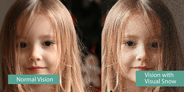 Forms and Surveys - Find a Behavioural Optometrist for Your Child in ...